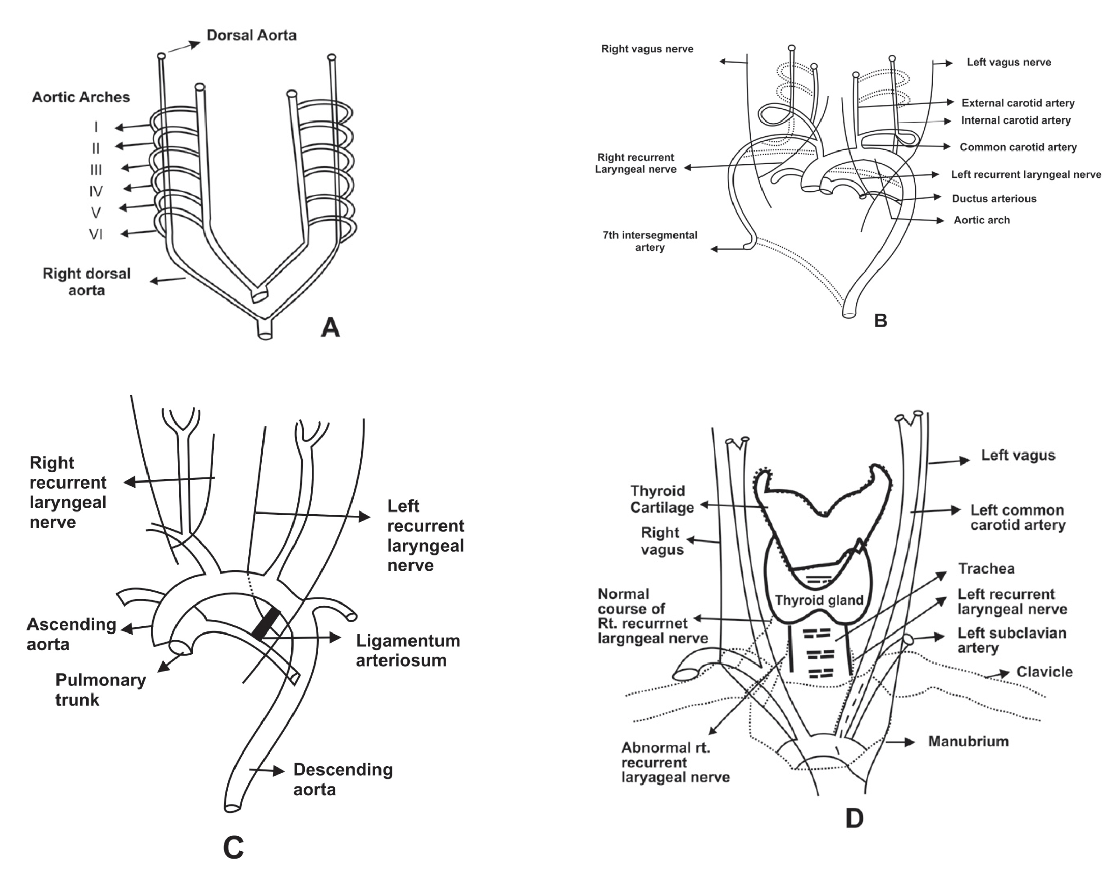 Recurrent Laryngeal Nerve